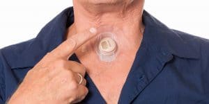 Patient's story | The Laryngectomy Site